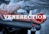 Venesection Therapy In Delhi, Procedure, Risk, Tips, and FAQ's